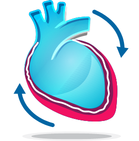 Recurrent Pericarditis